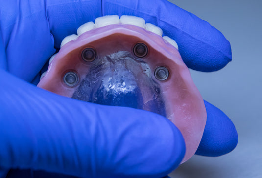 Implant Retained Dentures digitally crafted in Ireland. – Studio A ...